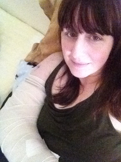 Ulnar nerve entrapment & tennis elbow surgery, day 5 – Student, Writers ...